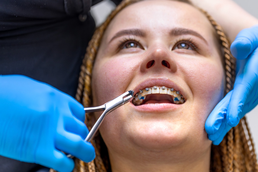 Cheap Braces in Singapore: What to Expect and Where to Look